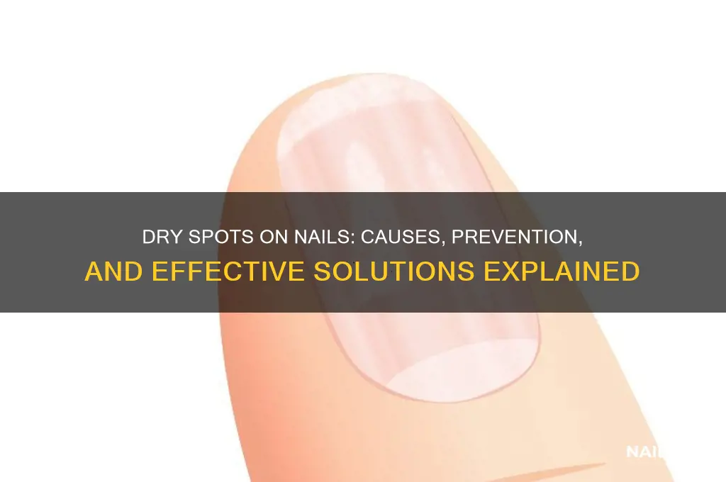 Dry Spots On Nails: Causes, Prevention, And Effective Solutions ...