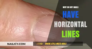 Missing Nail Half Moons: Causes And What They Reveal About Health | Nailicy