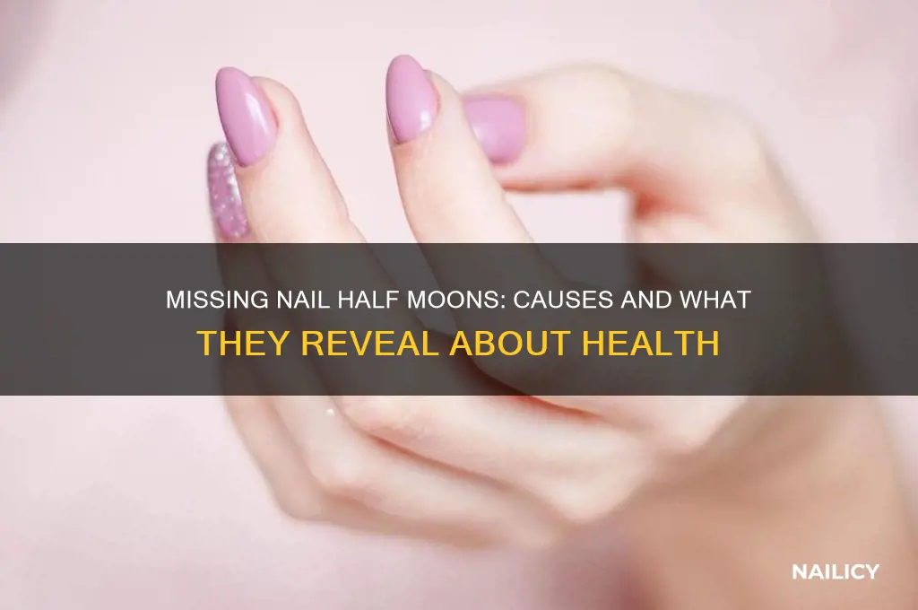 Missing Nail Half Moons: Causes And What They Reveal About Health | Nailicy