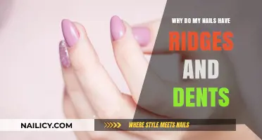 Missing Nail Half Moons: Causes And What They Reveal About Health | Nailicy