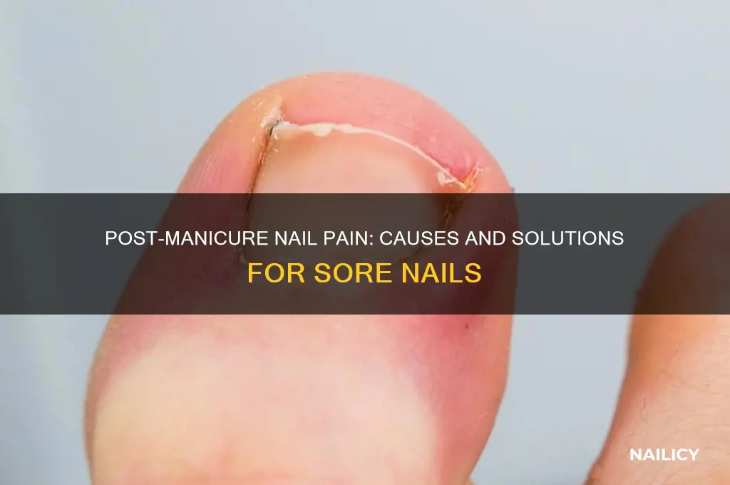 Post-Manicure Nail Pain: Causes And Solutions For Sore Nails | Nailicy