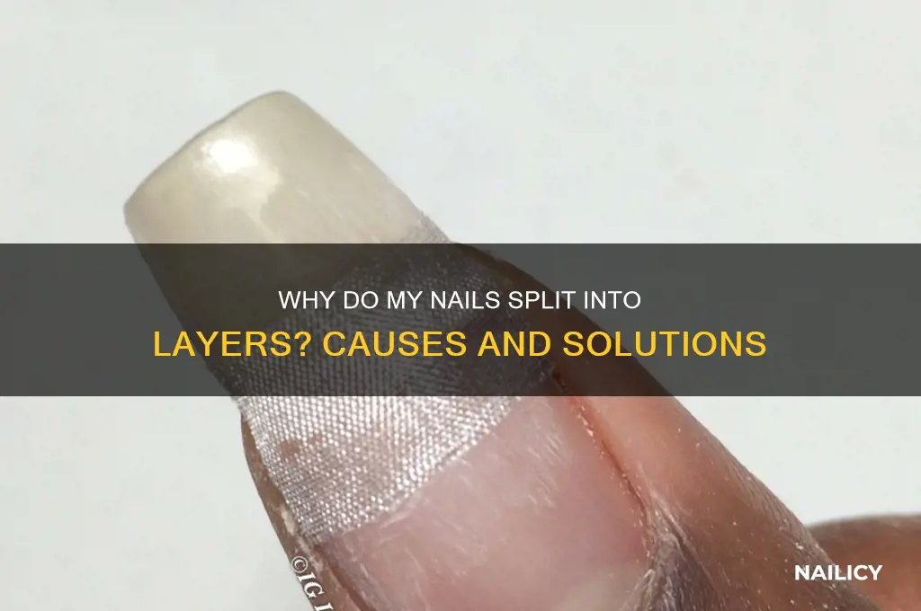 Why Do My Nails Split Into Layers? Causes And Solutions | Nailicy