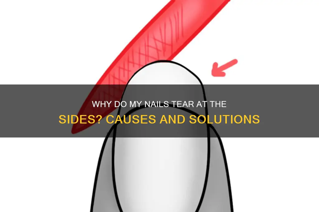 Why Do My Nails Tear At The Sides? Causes And Solutions | Nailicy
