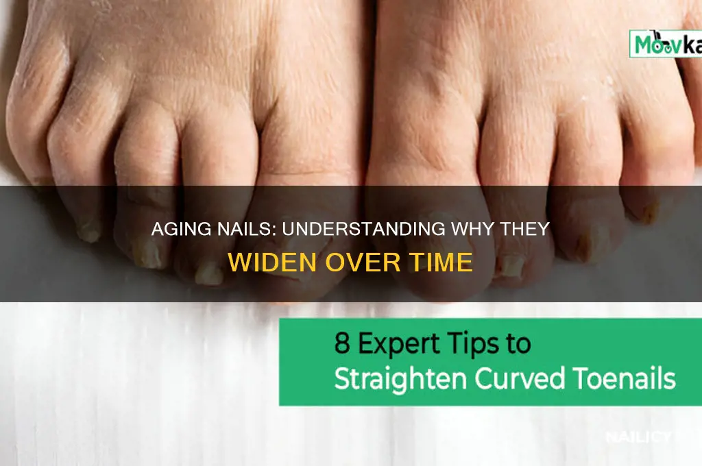 Aging Nails: Understanding Why They Widen Over Time | Nailicy