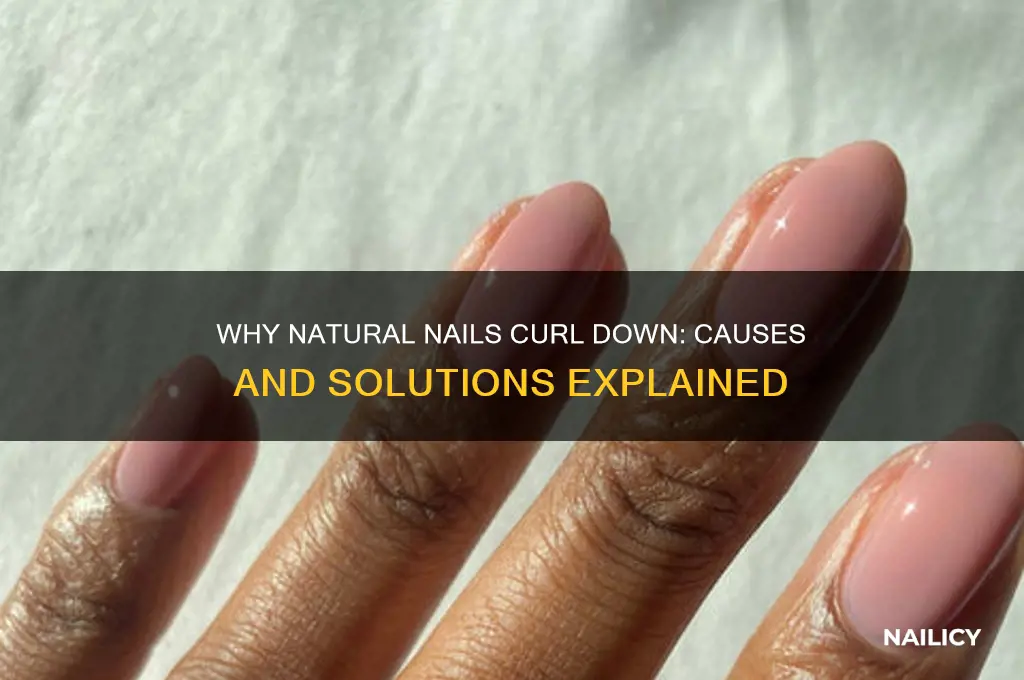 Why Natural Nails Curl Down: Causes And Solutions Explained | Nailicy
