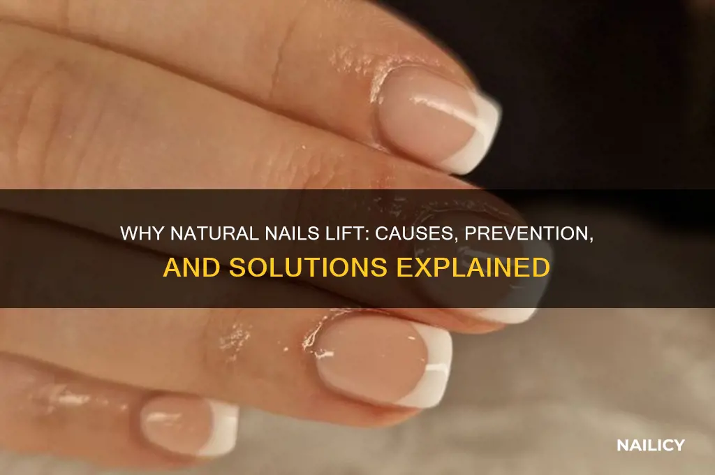 Why Natural Nails Lift: Causes, Prevention, And Solutions Explained ...