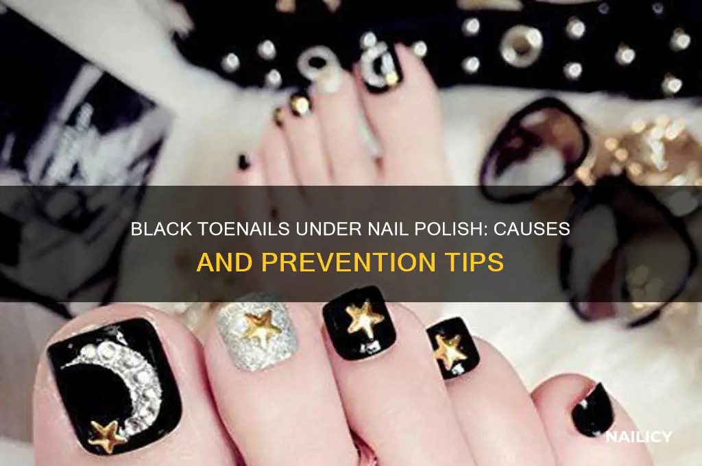 Black Toenails Under Nail Polish: Causes And Prevention Tips | Nailicy