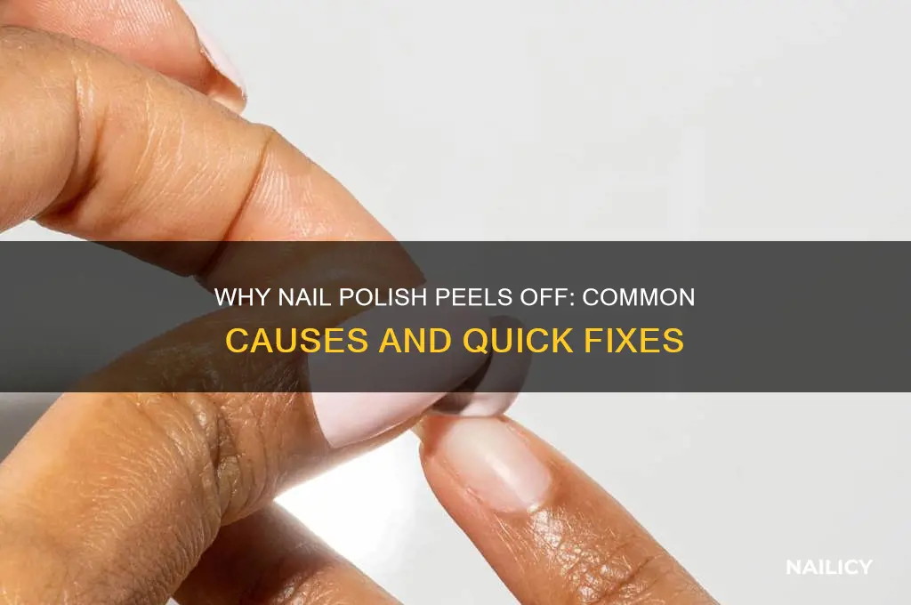 Why Nail Polish Peels Off: Common Causes And Quick Fixes | Nailicy