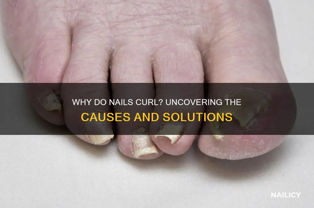 Why Do Nails Curl? Uncovering The Causes And Solutions | Nailicy
