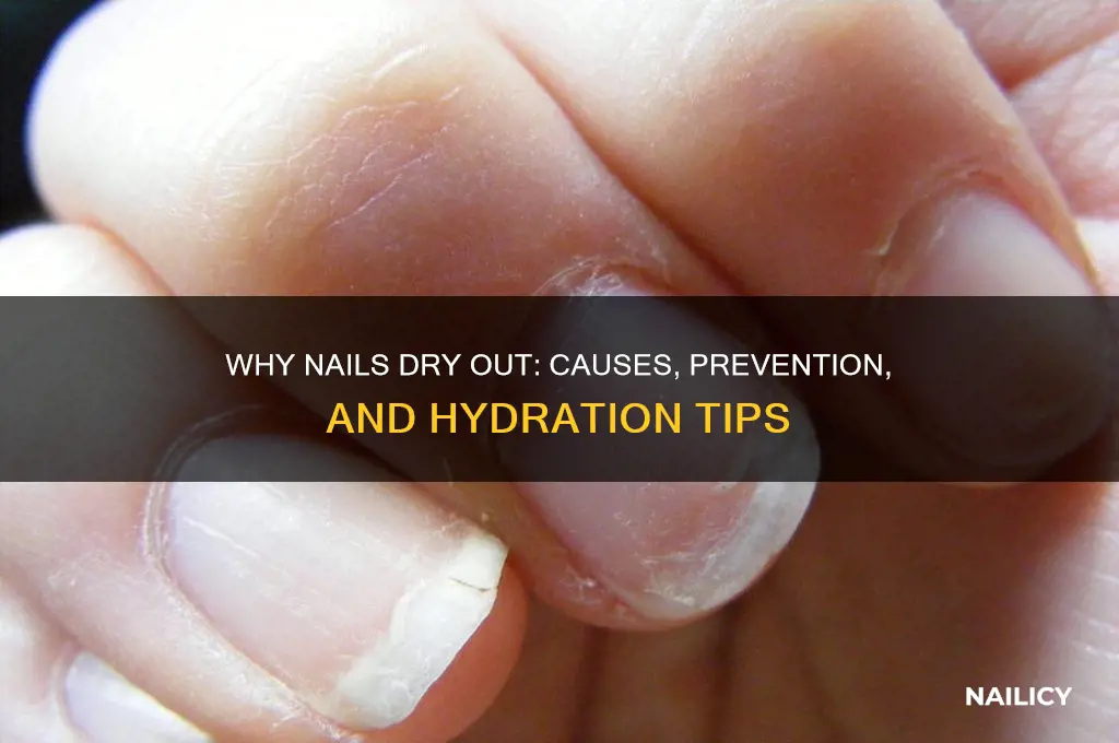 Why Nails Dry Out: Causes, Prevention, And Hydration Tips | Nailicy