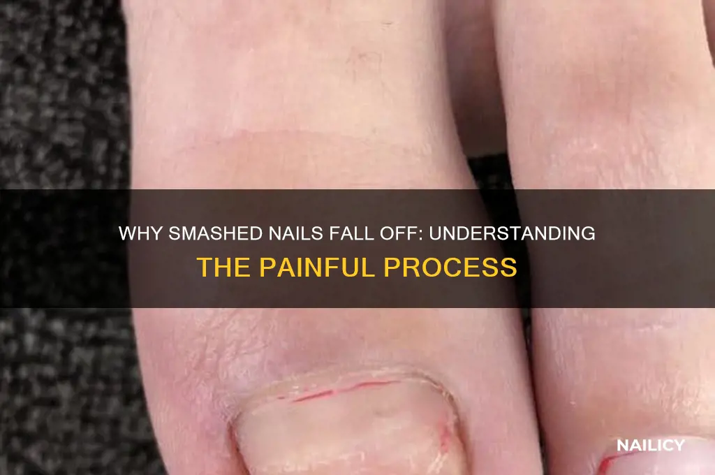 Why Smashed Nails Fall Off: Understanding The Painful Process | Nailicy