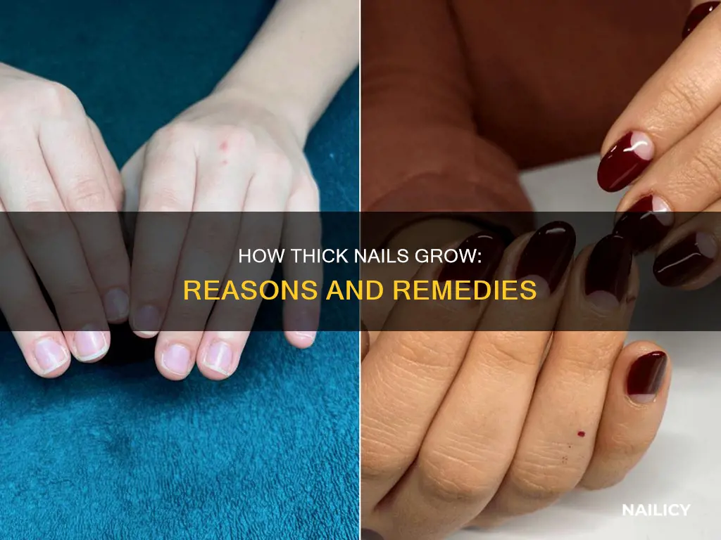 How Thick Nails Grow: Reasons And Remedies | Nailicy