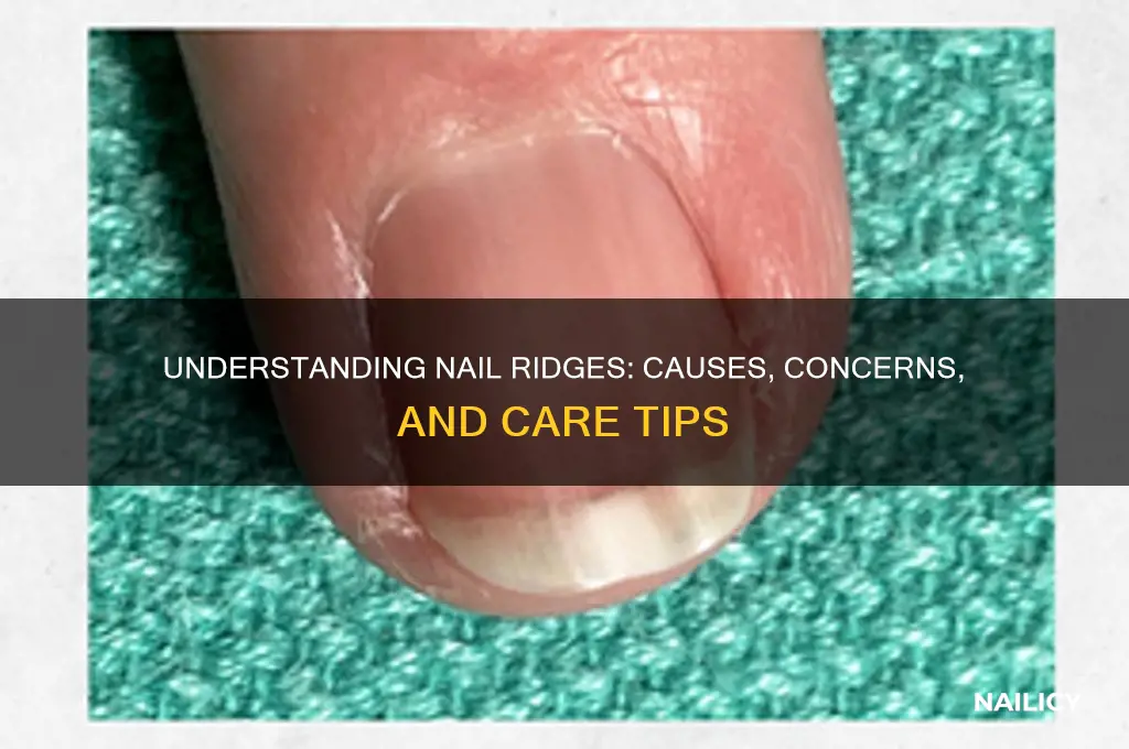Understanding Nail Ridges: Causes, Concerns, And Care Tips | Nailicy