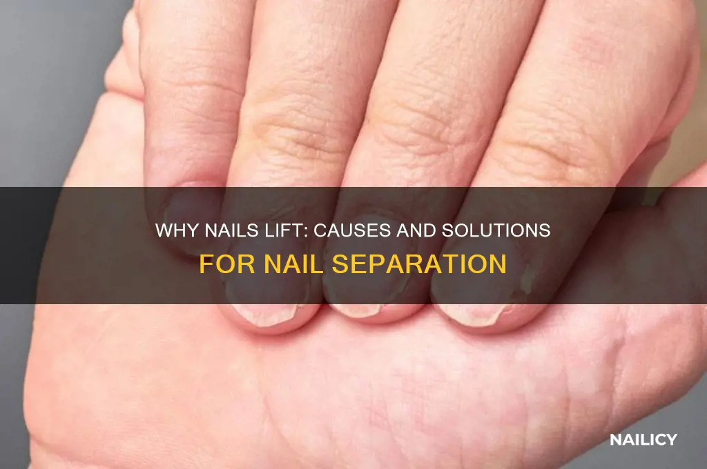 Why Nails Lift: Causes And Solutions For Nail Separation | Nailicy