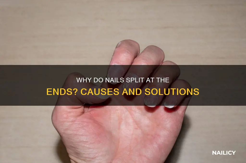 Why Do Nails Split At The Ends? Causes And Solutions | Nailicy