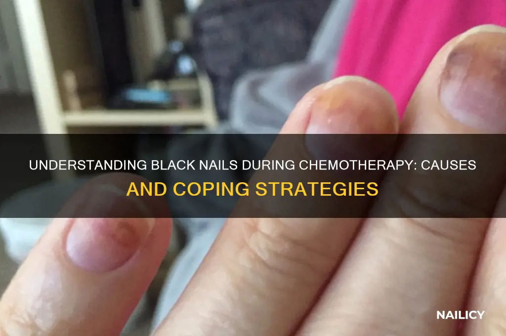 Understanding Black Nails During Chemotherapy: Causes And Coping ...
