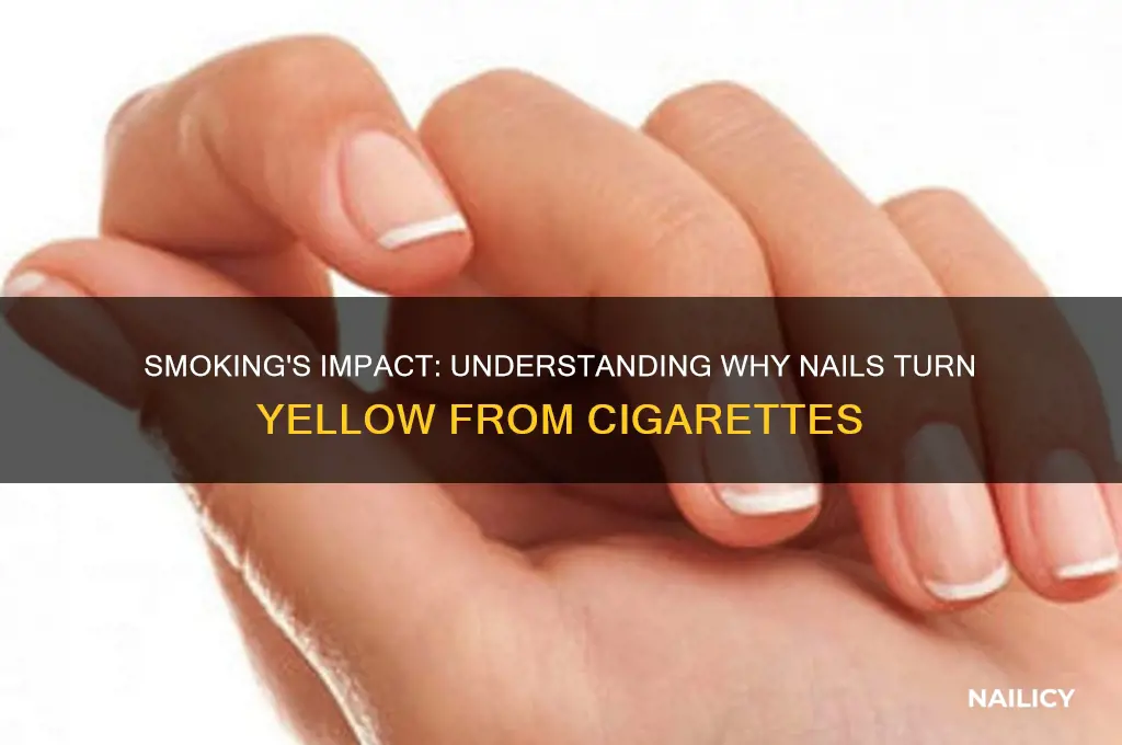 Smoking's Impact: Understanding Why Nails Turn Yellow From Cigarettes ...