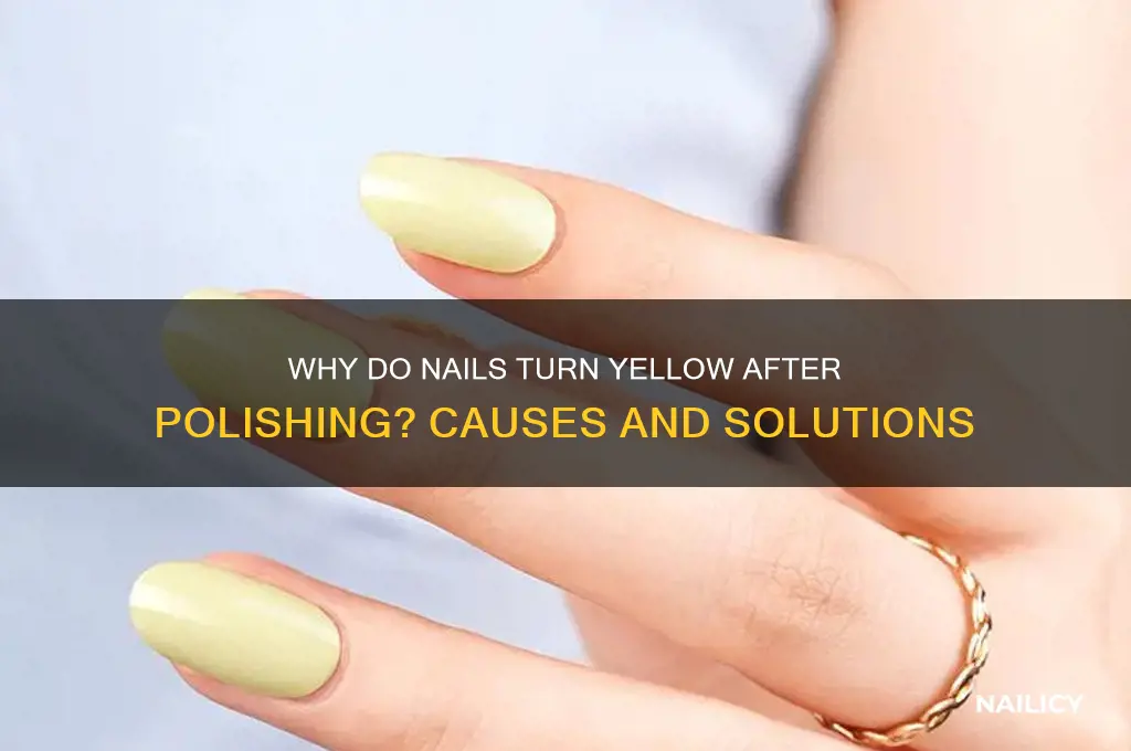 Why Do Nails Turn Yellow After Polishing? Causes And Solutions | Nailicy