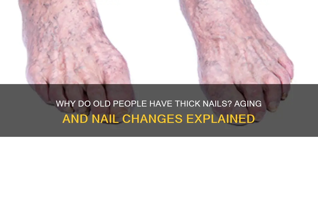 Why Do Old People Have Thick Nails? Aging And Nail Changes Explained ...