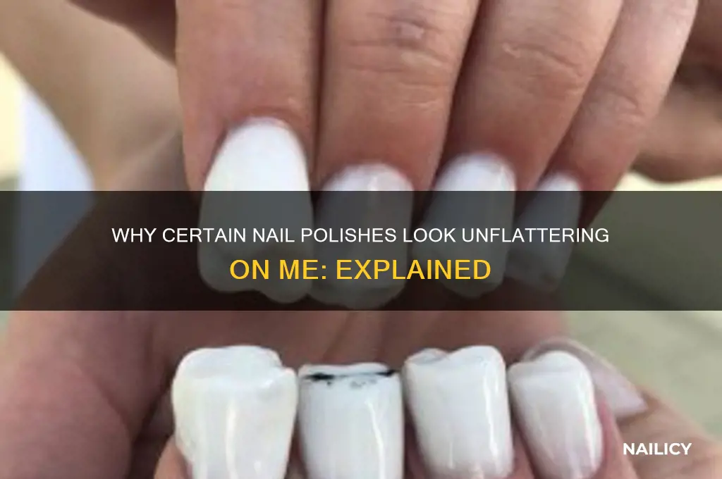 Why Certain Nail Polishes Look Unflattering On Me: Explained | Nailicy