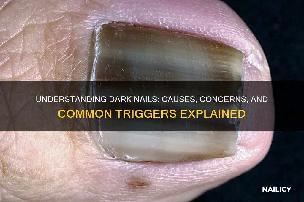 Understanding Dark Nails: Causes, Concerns, And Common Triggers ...