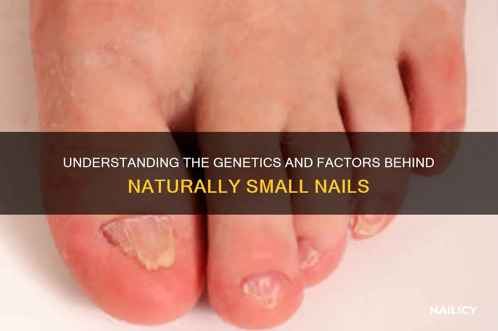 Understanding The Genetics And Factors Behind Naturally Small Nails ...