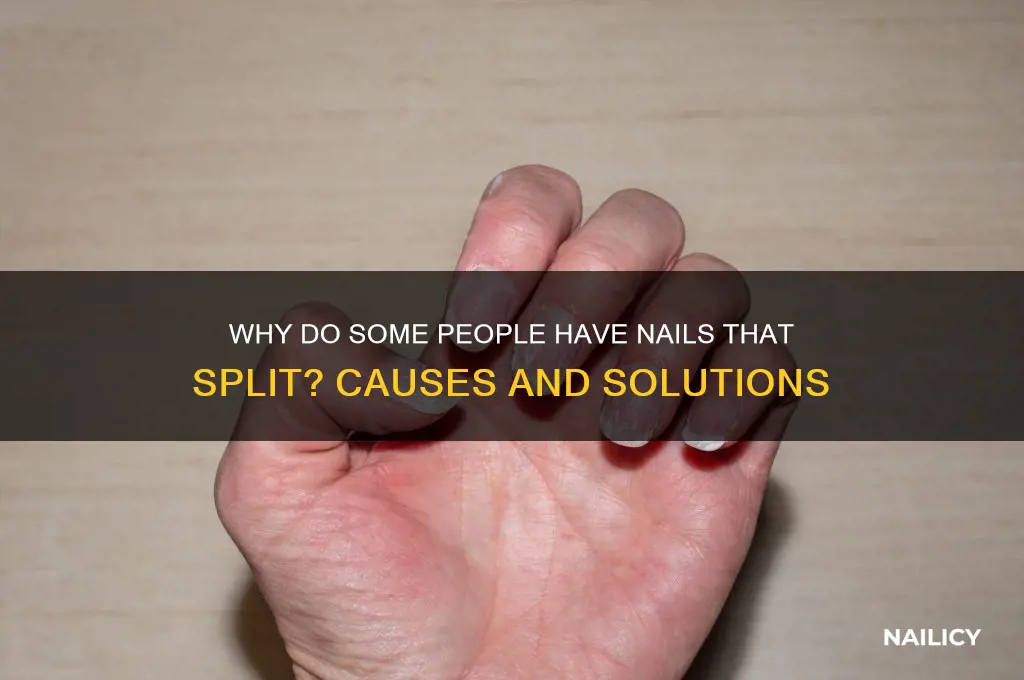 Why Do Some People Have Nails That Split? Causes And Solutions | Nailicy