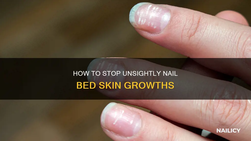 How To Stop Unsightly Nail Bed Skin Growths | Nailicy