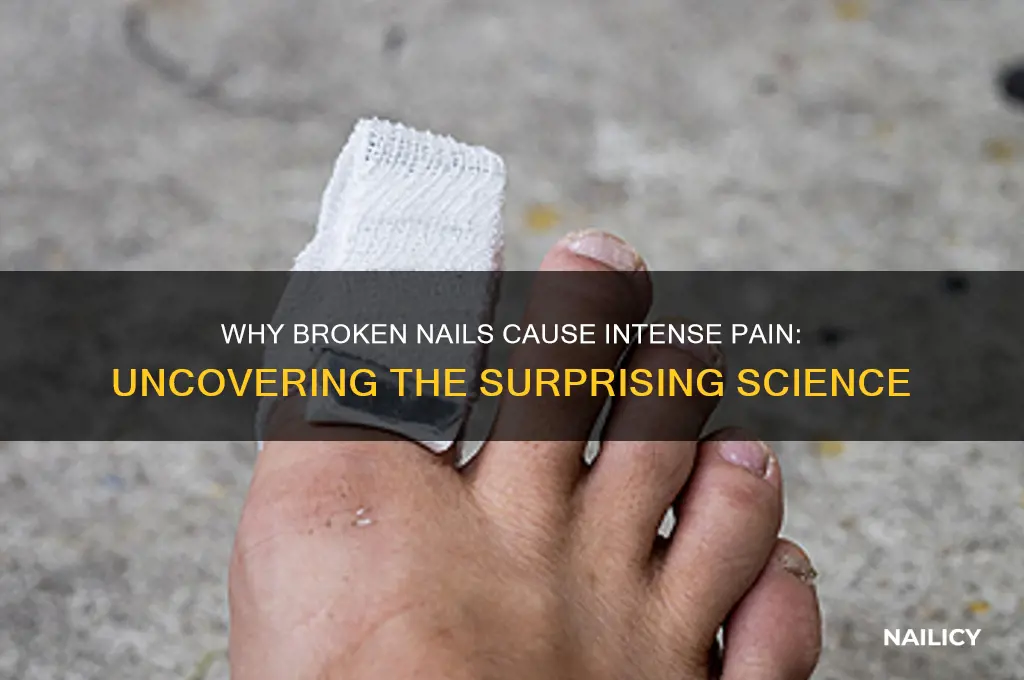 Why Broken Nails Cause Intense Pain: Uncovering The Surprising Science ...