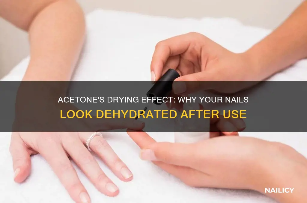 Acetone's Drying Effect: Why Your Nails Look Dehydrated After Use | Nailicy