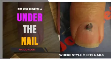 Why Blood Pools Under Nails: Causes, Risks, And Remedies | Nailicy