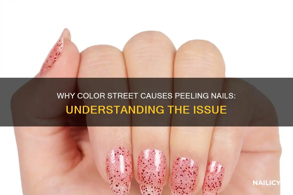 Why Color Street Causes Peeling Nails: Understanding The Issue | Nailicy