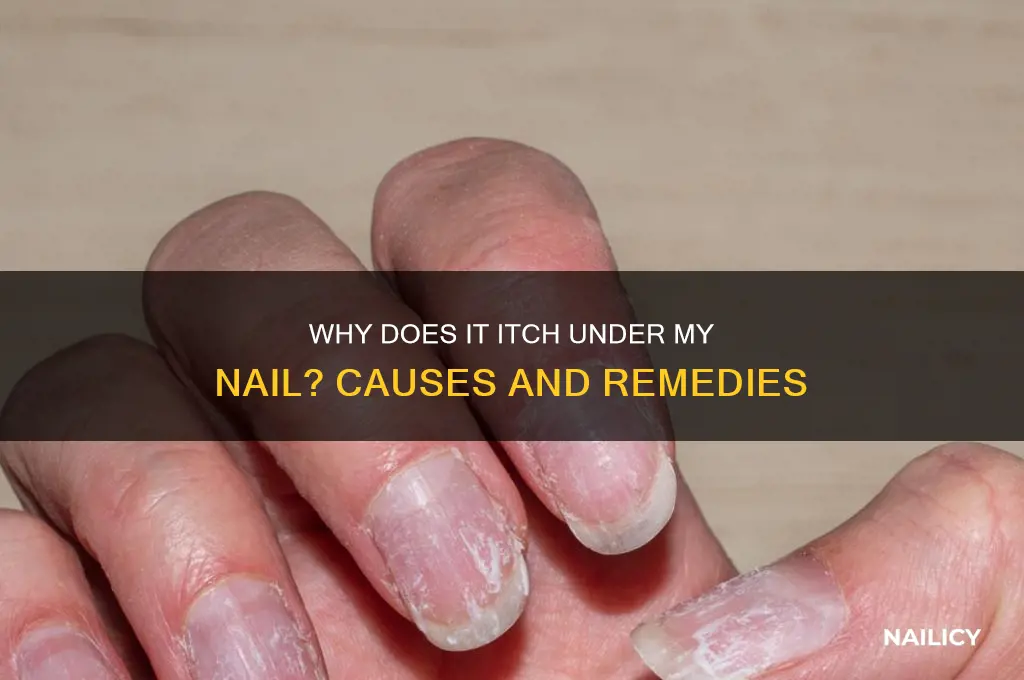 Why Does It Itch Under My Nail? Causes And Remedies | Nailicy