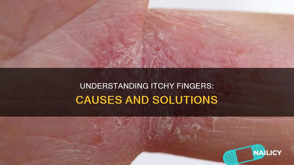 Understanding Itchy Fingers: Causes And Solutions | Nailicy