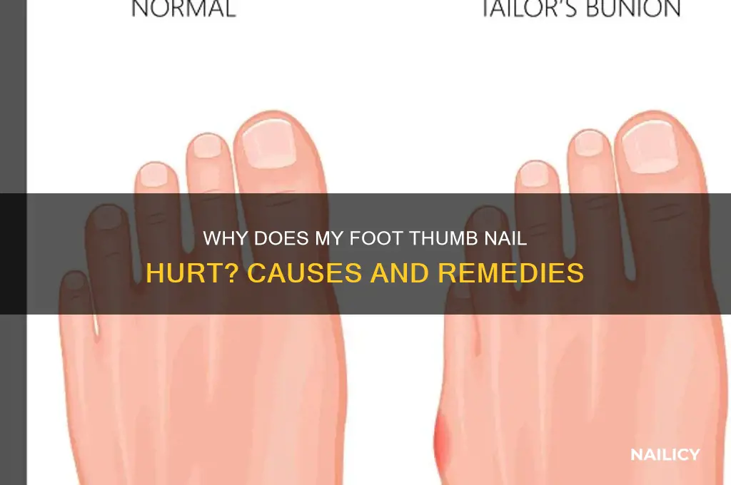 Why Does My Foot Thumb Nail Hurt? Causes And Remedies | Nailicy