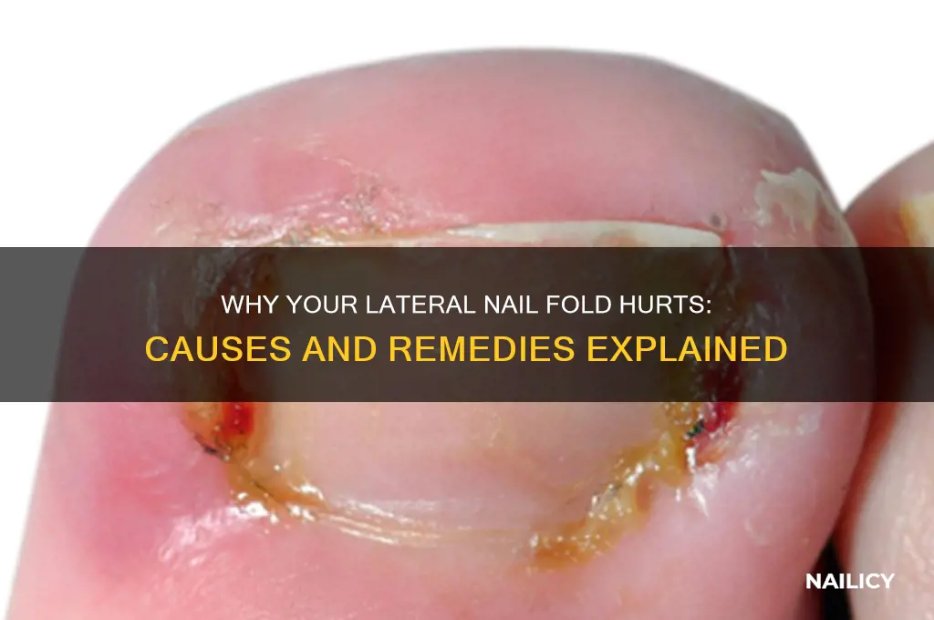 Why Your Lateral Nail Fold Hurts: Causes And Remedies Explained | Nailicy