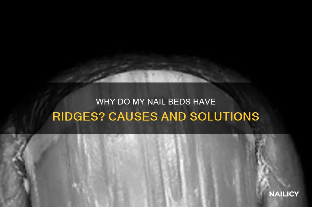 Why Do My Nail Beds Have Ridges? Causes And Solutions | Nailicy