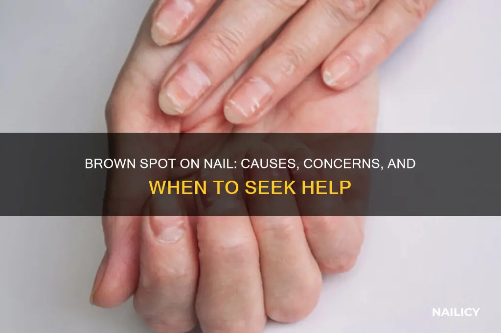 Brown Spot On Nail: Causes, Concerns, And When To Seek Help | Nailicy