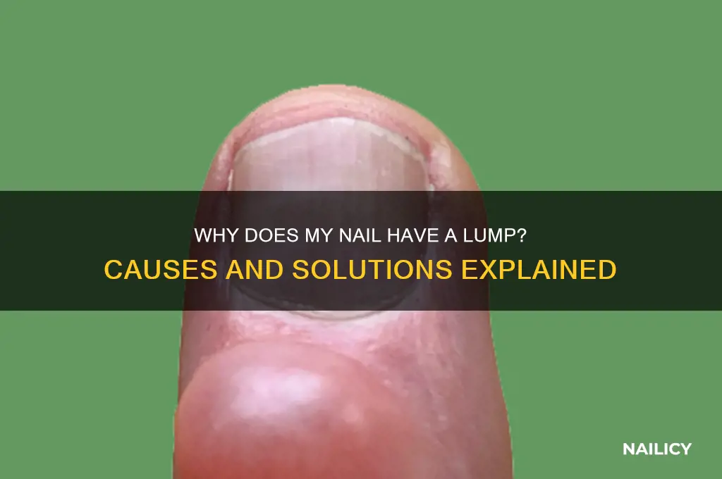Why Does My Nail Have A Lump? Causes And Solutions Explained | Nailicy