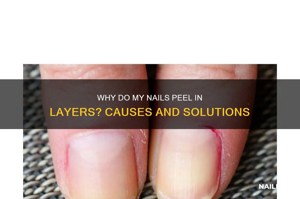 Why Do My Nails Peel In Layers? Causes And Solutions | Nailicy