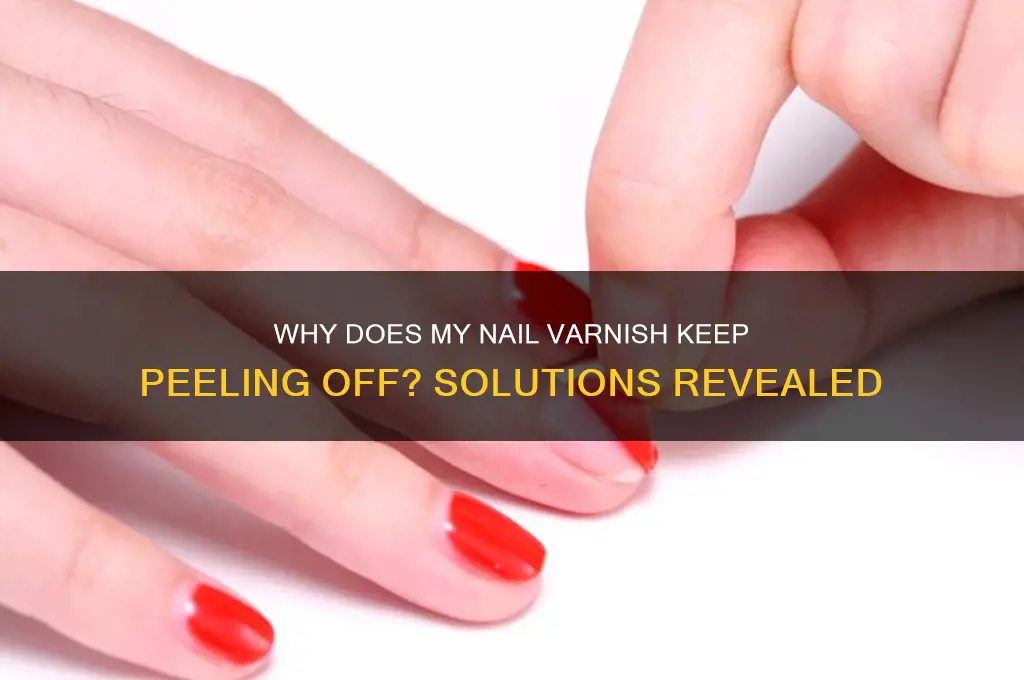 Why Does My Nail Varnish Keep Peeling Off? Solutions Revealed | Nailicy