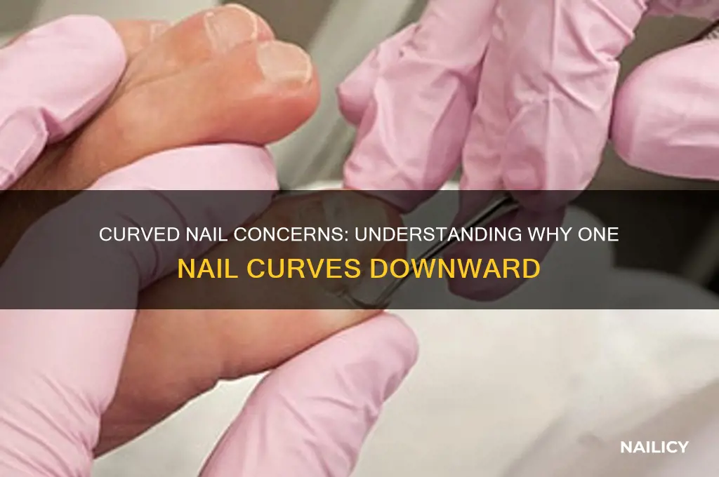 Curved Nail Concerns: Understanding Why One Nail Curves Downward | Nailicy