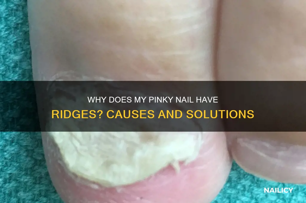 Why Does My Pinky Nail Have Ridges? Causes And Solutions | Nailicy