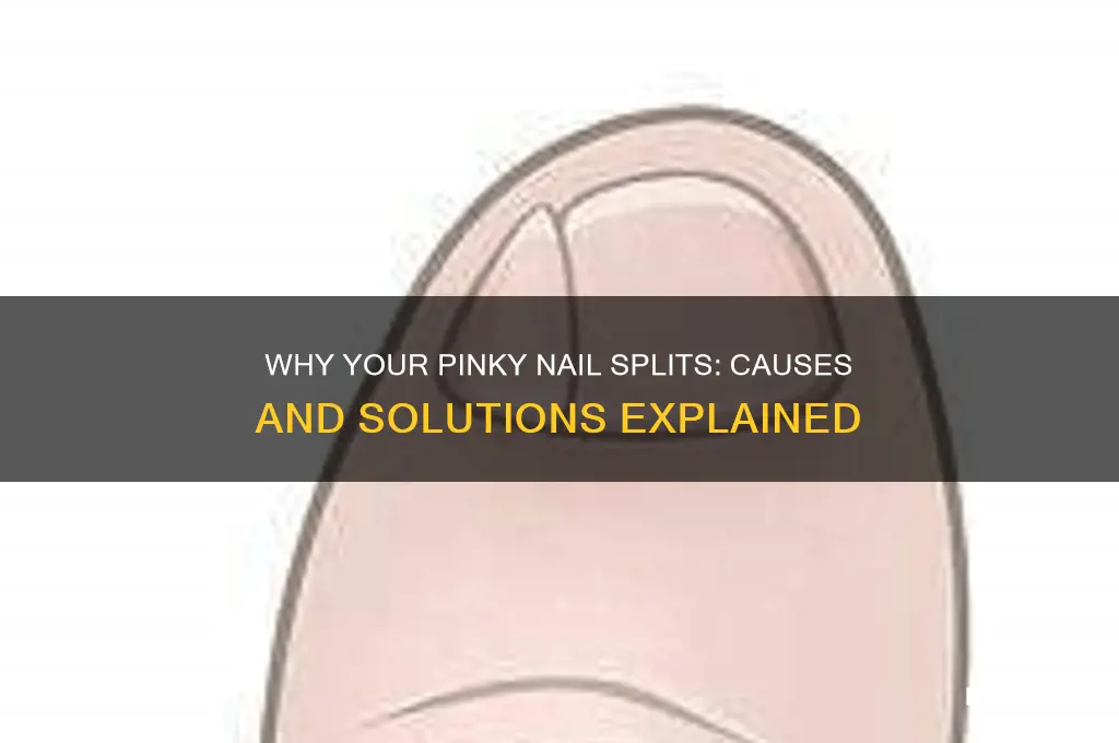 Why Your Pinky Nail Splits: Causes And Solutions Explained | Nailicy