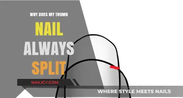 Why Horizontal Ridges Appear On Your Thumb Nail: Causes Explained | Nailicy