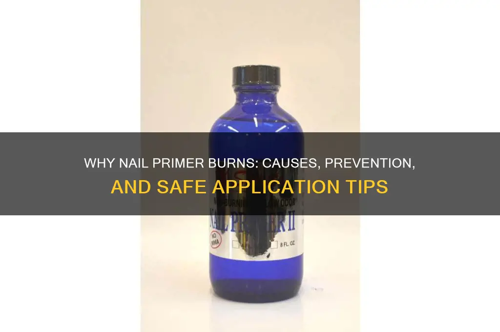 Why Nail Primer Burns: Causes, Prevention, And Safe Application Tips ...