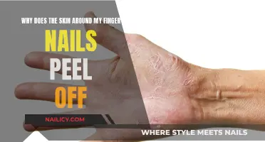 The Itch Under Fingernails: Causes And Cures | Nailicy