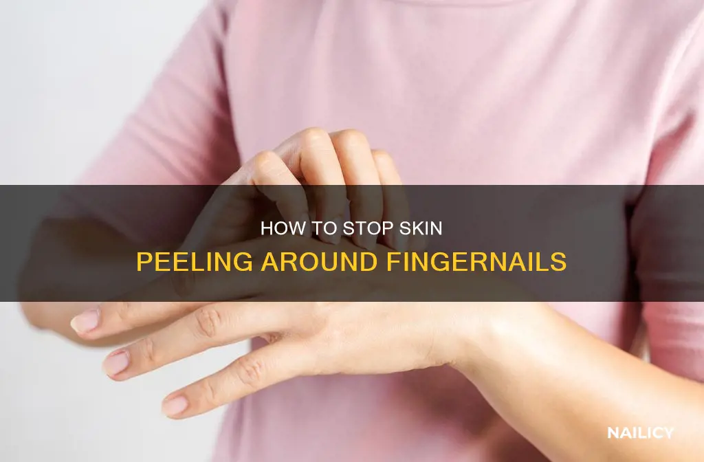 How To Stop Skin Peeling Around Fingernails | Nailicy