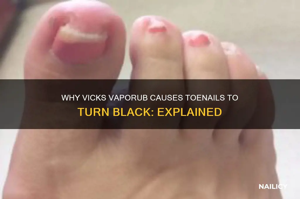 Why Vicks Vaporub Causes Toenails To Turn Black: Explained | Nailicy