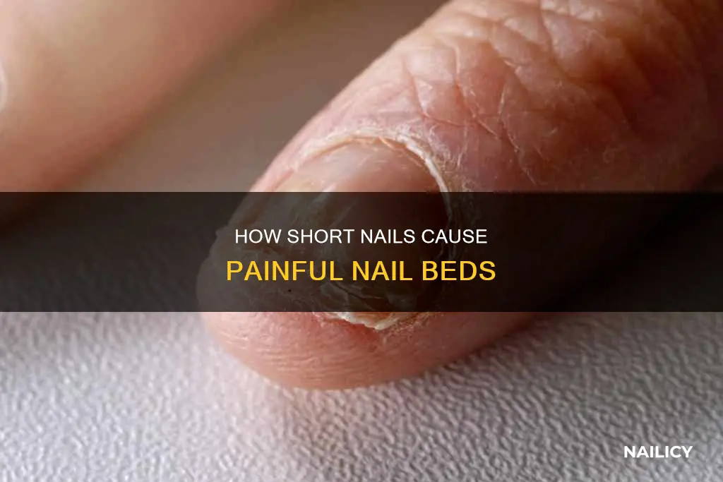 How Short Nails Cause Painful Nail Beds | Nailicy